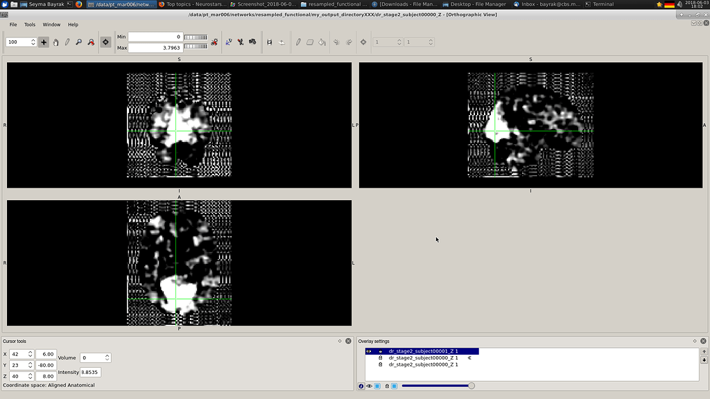 Fsl dual_regression - neuroimaging - Neurostars