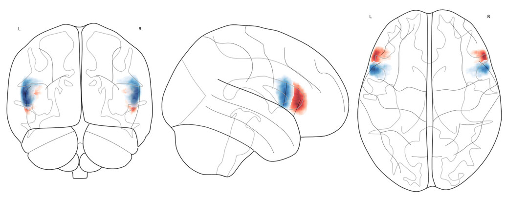 Trying to understand the markings on the glass brain plots - nilearn ...