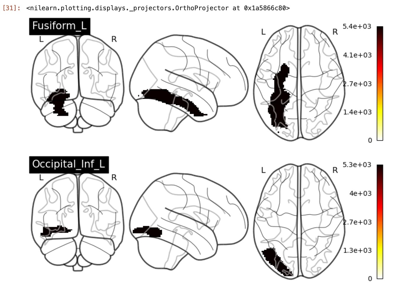 Visualize single regions from the aal atlas in nilearn - nilearn ...