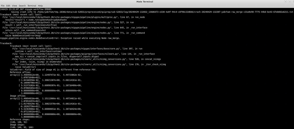 QSIPrep: Field of view of image #1 is different from reference FOV - Software Support - Neurostars