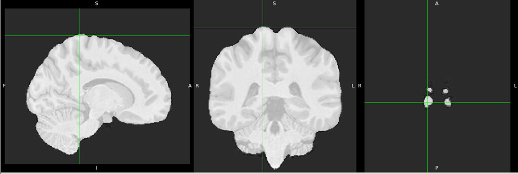 fMRIPrep - Creating functional masks from partial slabs - Neurostars