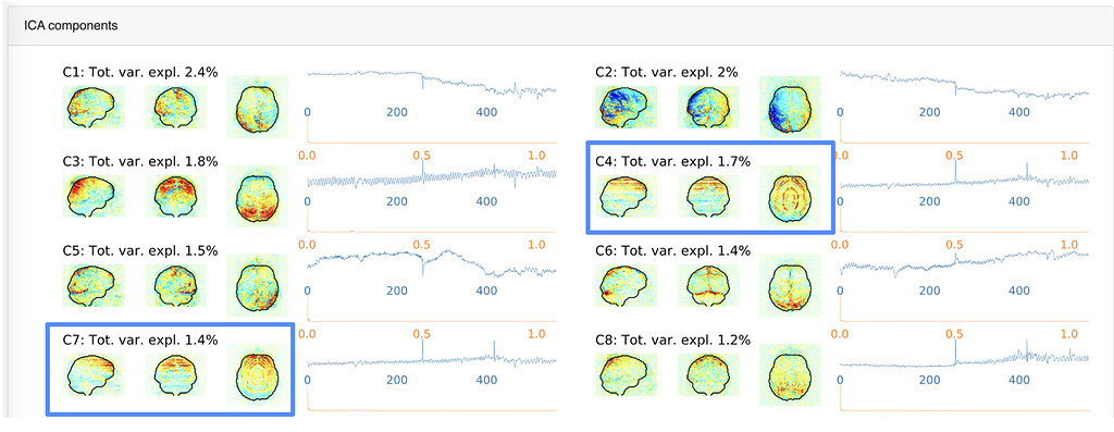 Gibbs artifact in EPI data - is it handled in fmriprep? - Neurostars
