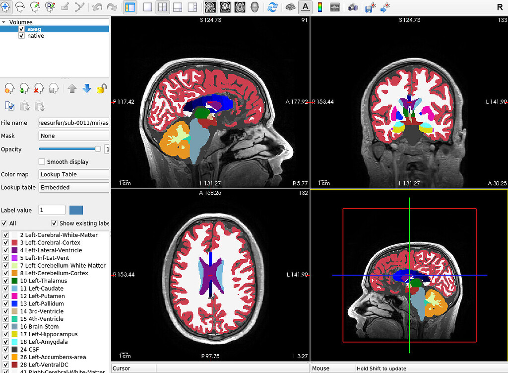 fMRIPrep & recon-all-clinical - Software Support - Neurostars