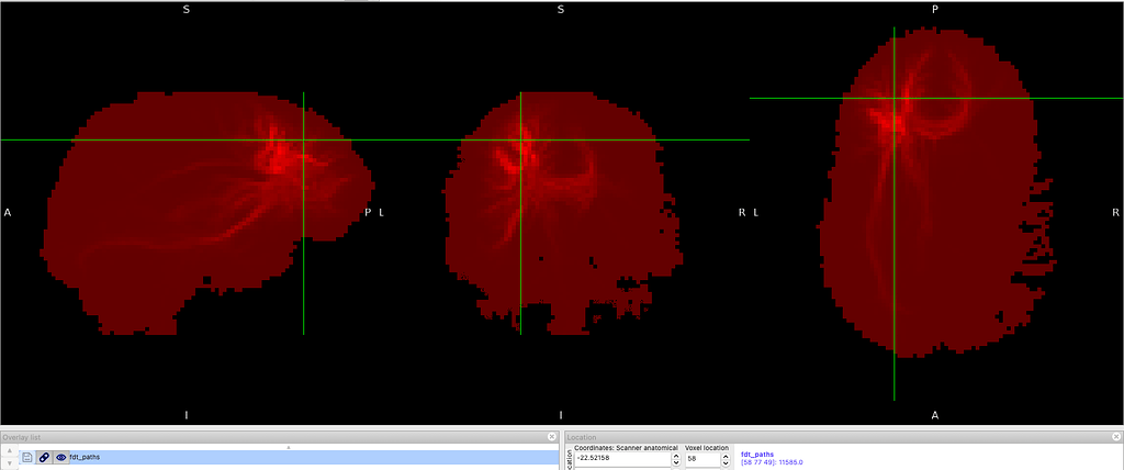 ANTs registration + transformation = outcome incorrectly registered ...