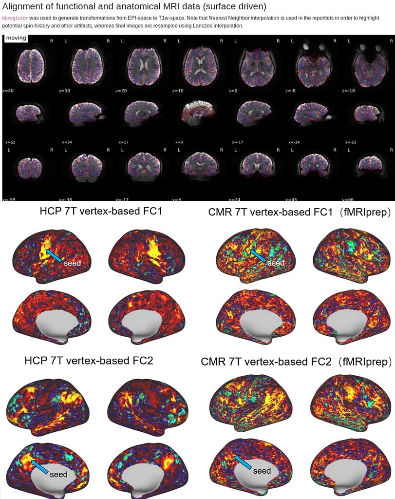 7T resting-state fMRI data in CIFTI format showed bad FC maps ...