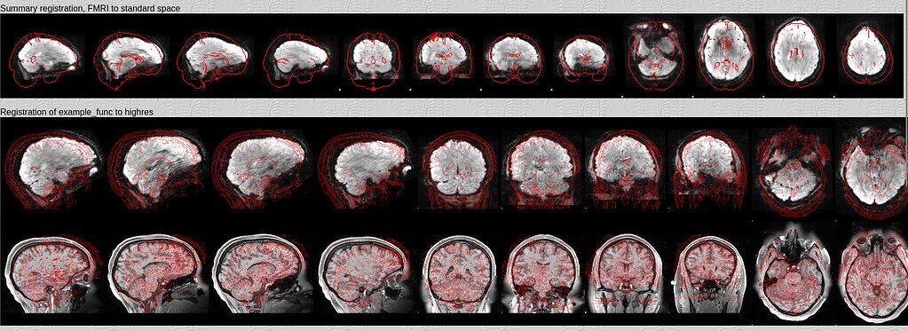How to improve fMRI registration in FSL? - Software Support - Neurostars