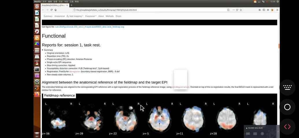 Use-syn-sdc and use-aroma use in fmriprep 24.0.1 - Software Support ...