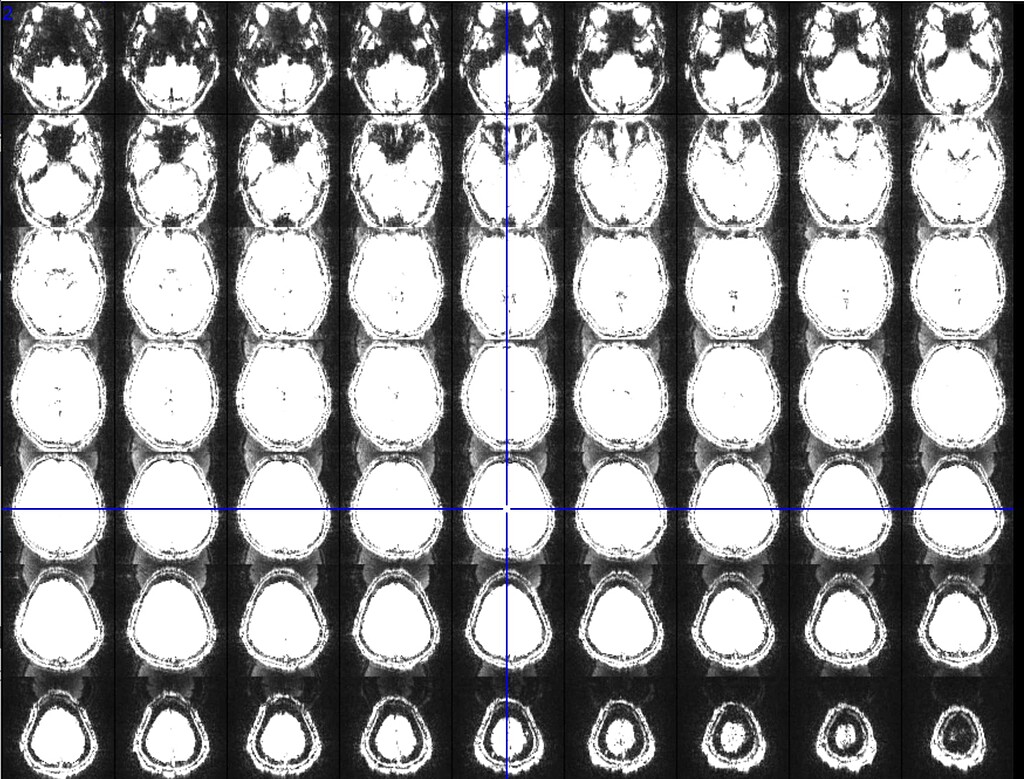 Suggestion about ghosting in BOLD images - fmri - Neurostars