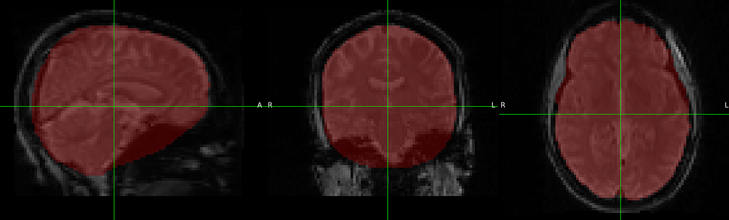 Fmriprep BOLD Brain Mask Including Non-Brain Tissue - fmriprep - Neurostars