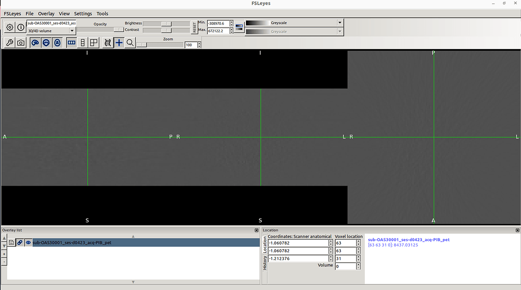 Cannot see PET image in FSLEYES - Neurostars