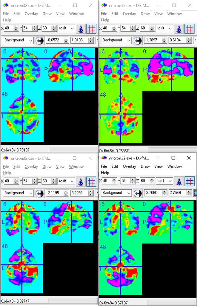 Different beta maps generated by nilearn and SPM - nilearn - Neurostars