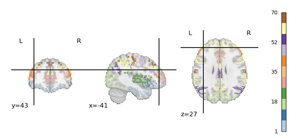Fit Talairach atlas in MNI space using Nilearn - nilearn - Neurostars