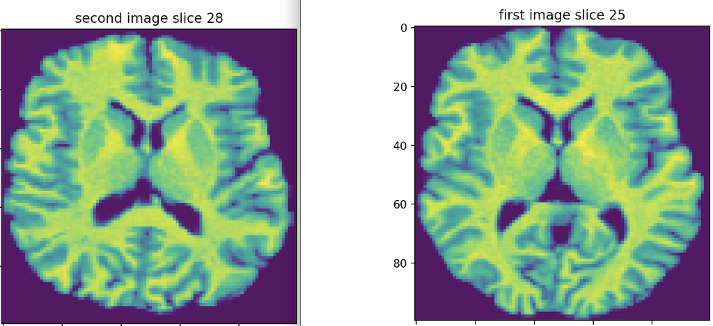 MRI Images with Different Axial Slice Number for the Same Subject - mri ...