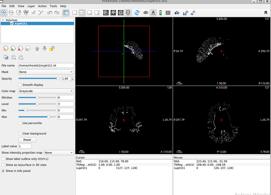 Help with Lobe Segmentation and 3D Visualization in FreeSurfer - Neurostars