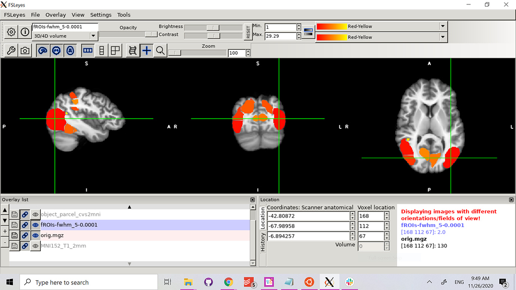 Freesurfer cvs_avg35 to MNI registration - freesurfer - Neurostars