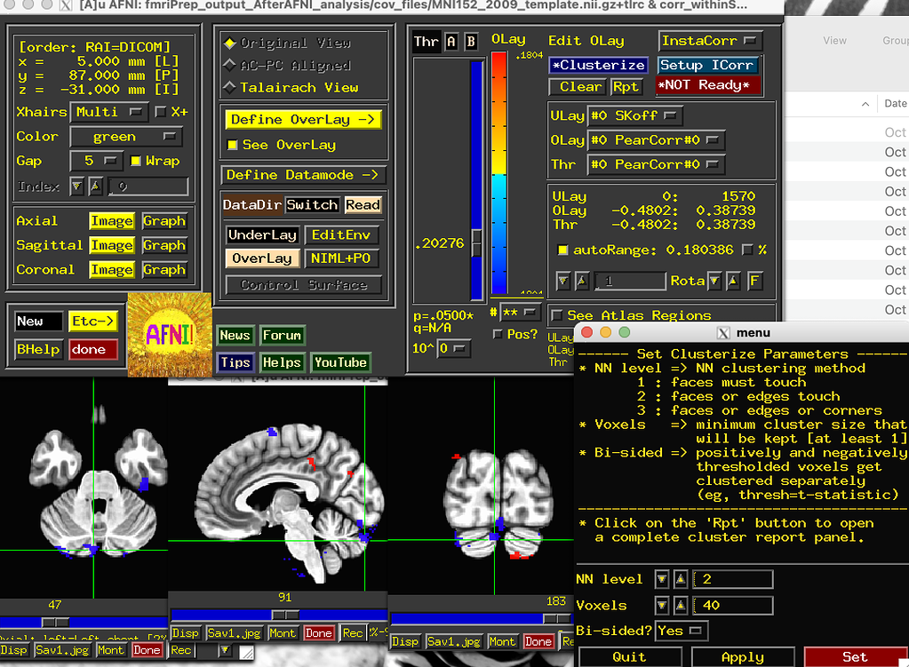 Help with Setting Threshold and Cluster Size in AFNI GUI After Running ...