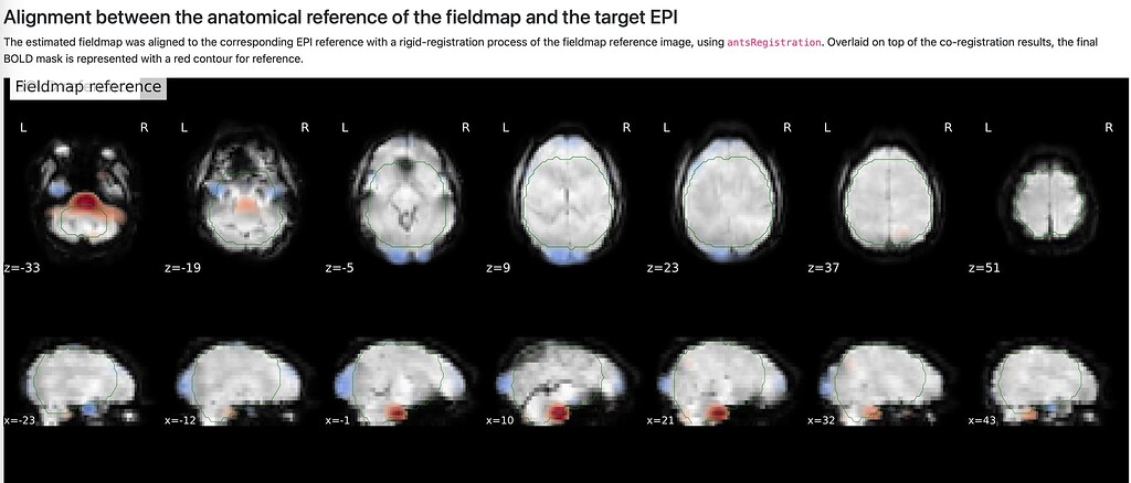 Brain Mask Generation In Fmriprep Software Support Neurostars