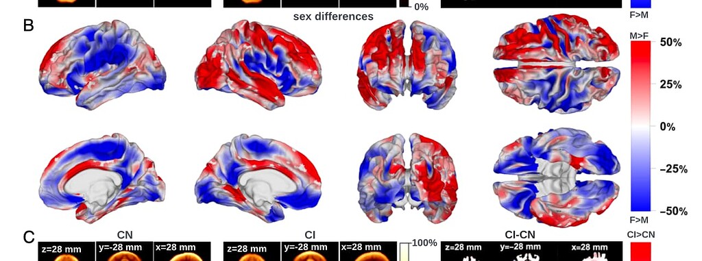 What tool to use for Brain visualisation? - neuroimaging - Neurostars