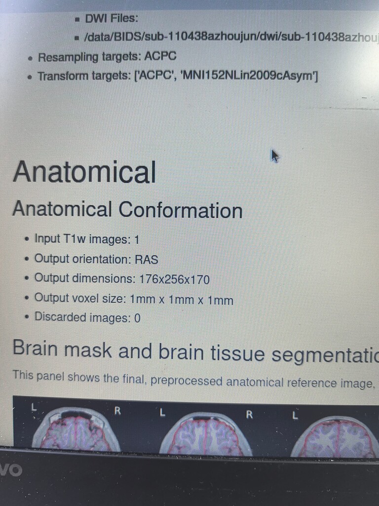 Anatomical output orientation of Qsiprep - Software Support - Neurostars