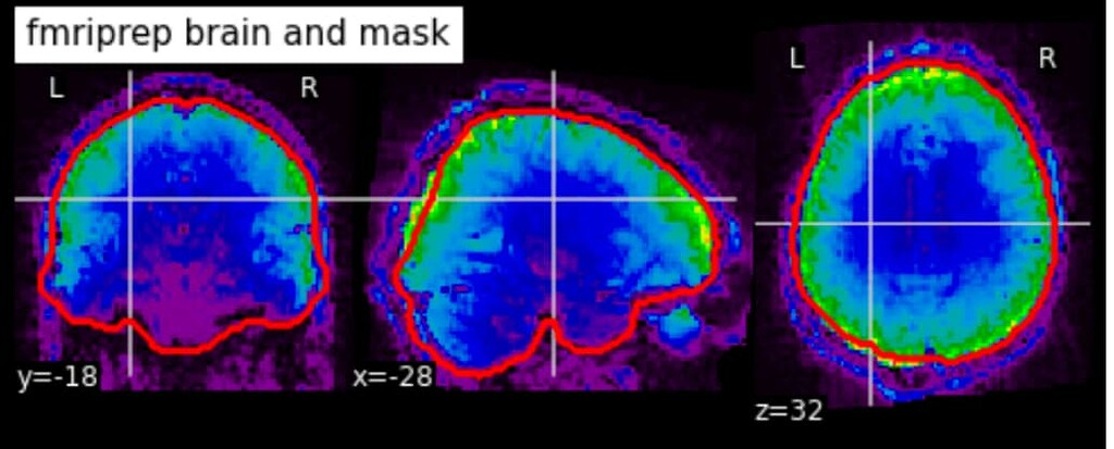 How can I improve the brain mask generated by nilearn's compute_epi ...