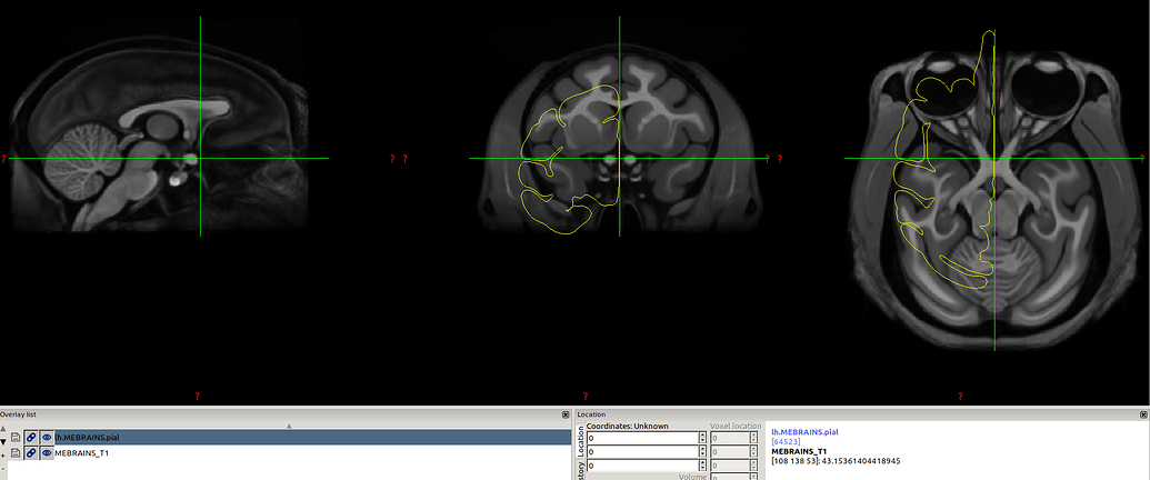 Transform freesurfer mesh coordinates to volume coordinates ...