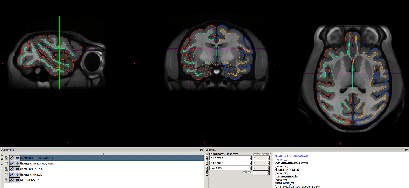 Transform freesurfer mesh coordinates to volume coordinates ...