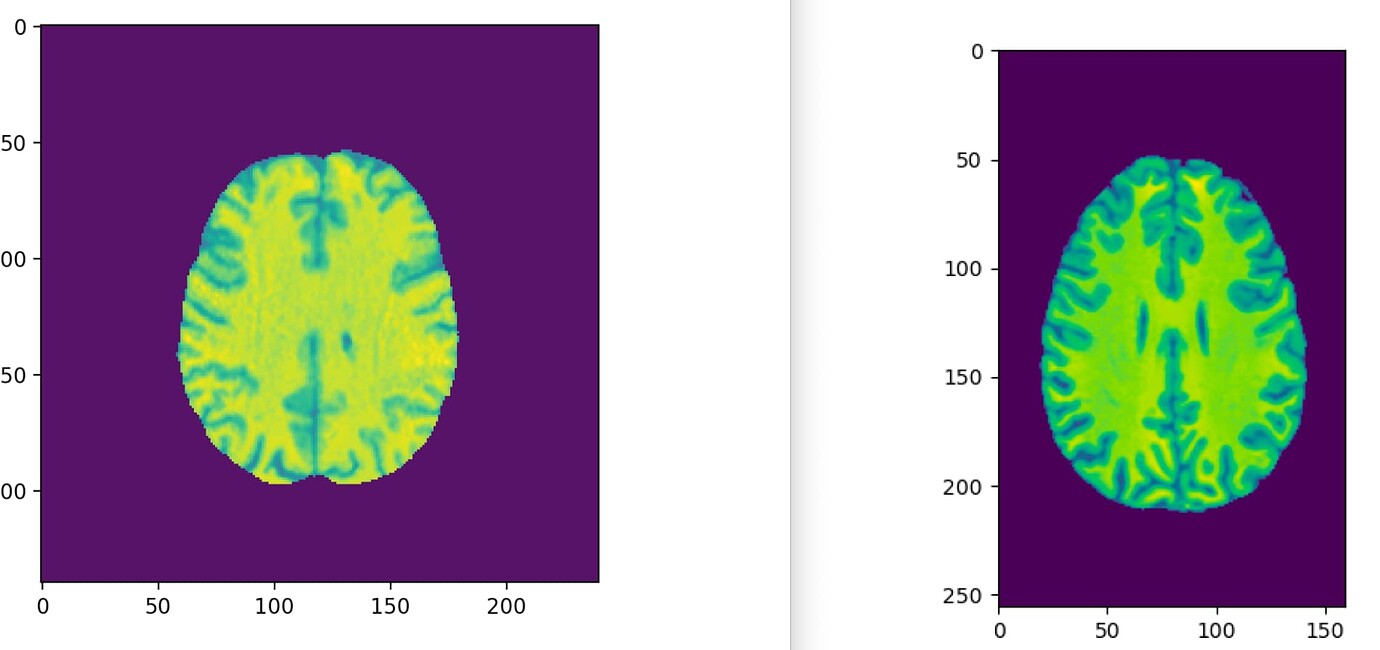 Difference Between T1 and T1W? - mri - Neurostars