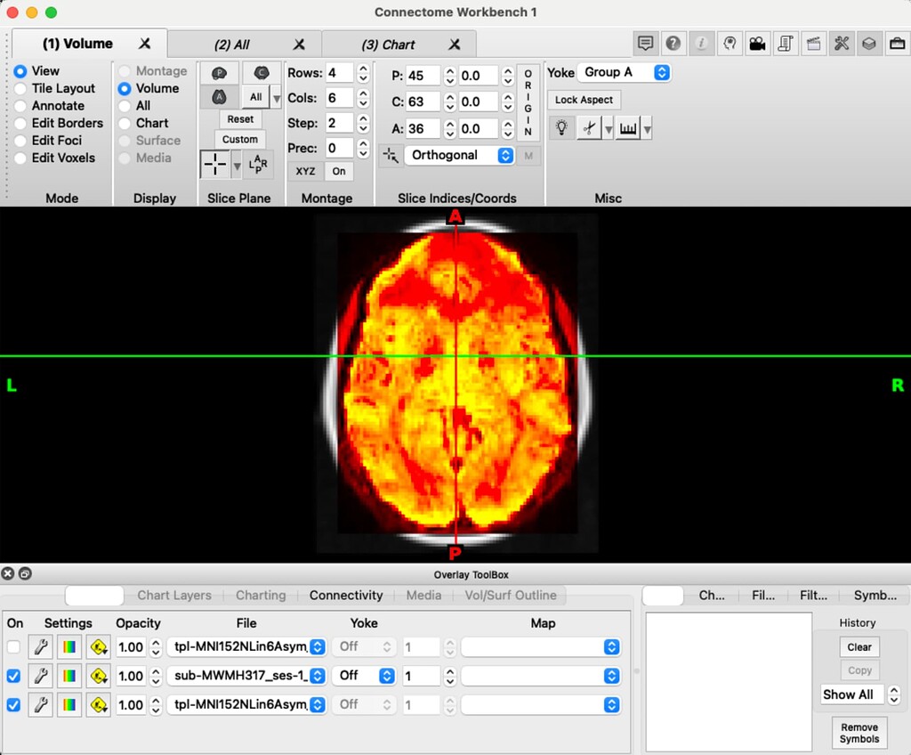 Getting subcortical data from fMRIPrep into fsLR 32k - fmriprep ...