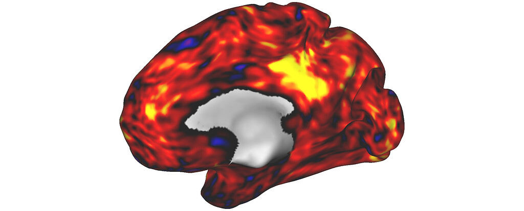Mapping HCP data from native to fsaverage surface - hcp-workbench ...