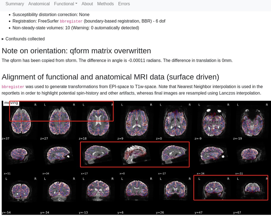 BBR registration algorithm performed poorly on 7T fMRI data - Neurostars