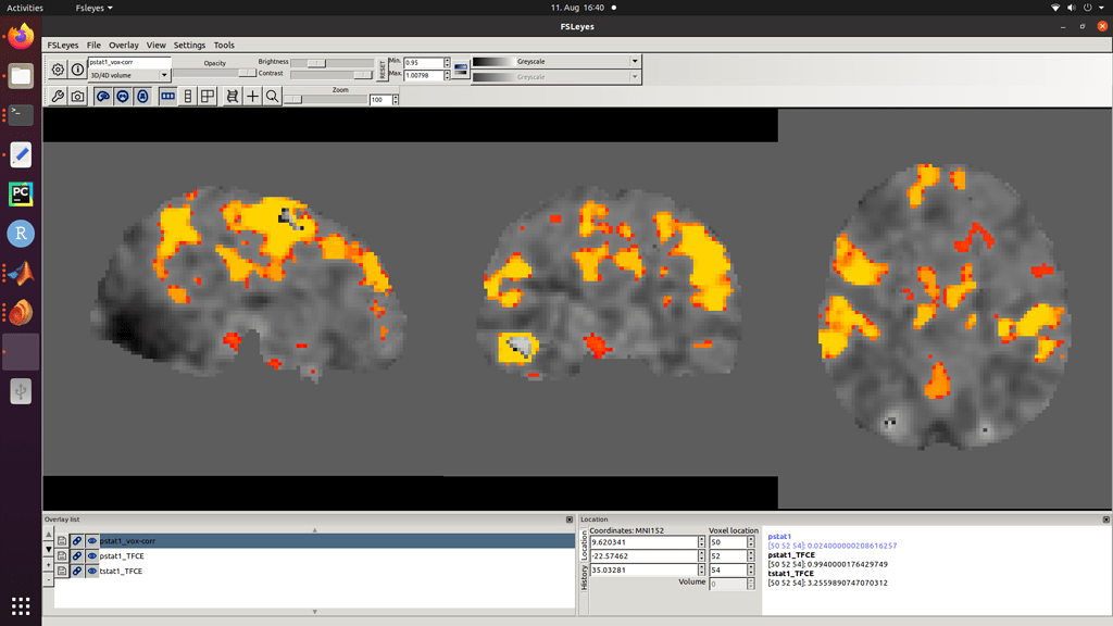 Extremely large clusters with TFCE using FSL randomise - fsl - Neurostars