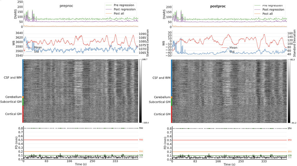 Summary report of XCP-D using multi-echo BOLD and TEDANA - Software Support - Neurostars