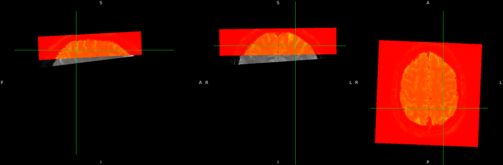 fMRIPrep coregistration issues with functional slab - Software Support ...