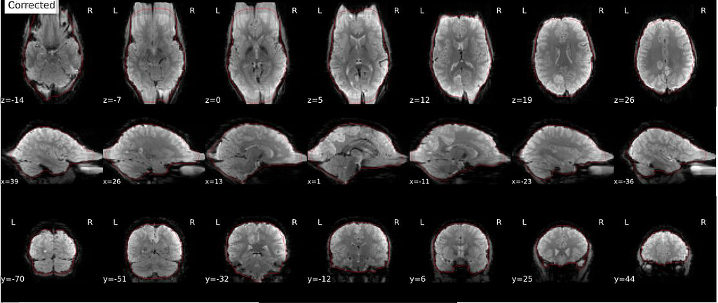 BOLD susceptibility distortion correction (SDC) using Spin Echo ...