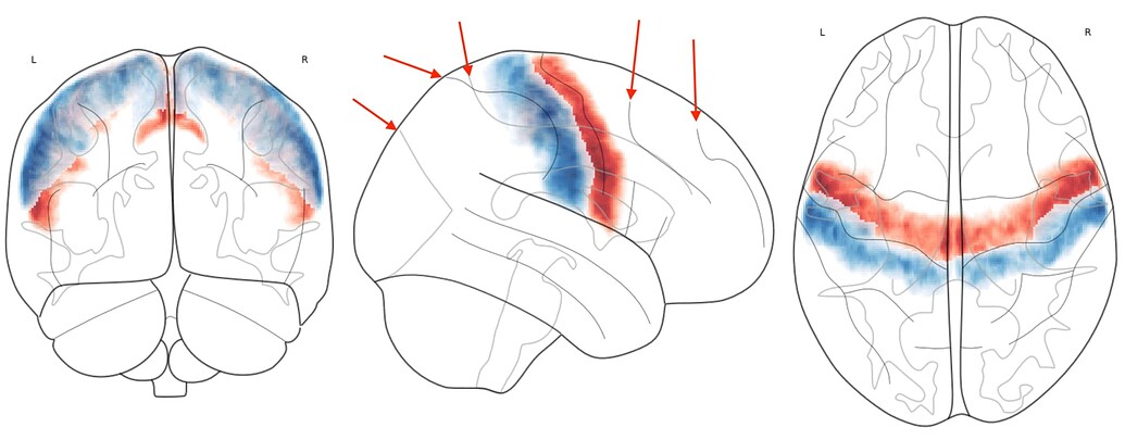 Trying to understand the markings on the glass brain plots - nilearn ...