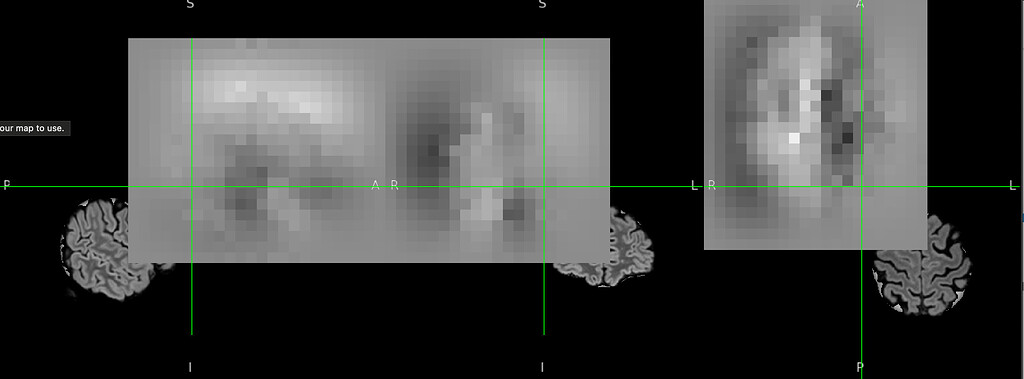 FSL FNIRT not working - Software Support - Neurostars