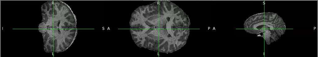 How can I improve ants brain extraction performance? - Software Support ...