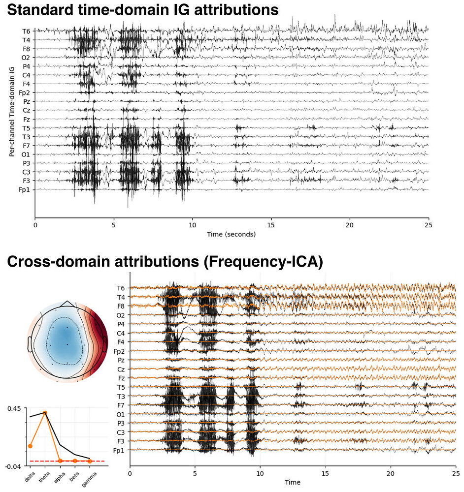 Explaining deep models of neural time-series signals: cross-domain ...