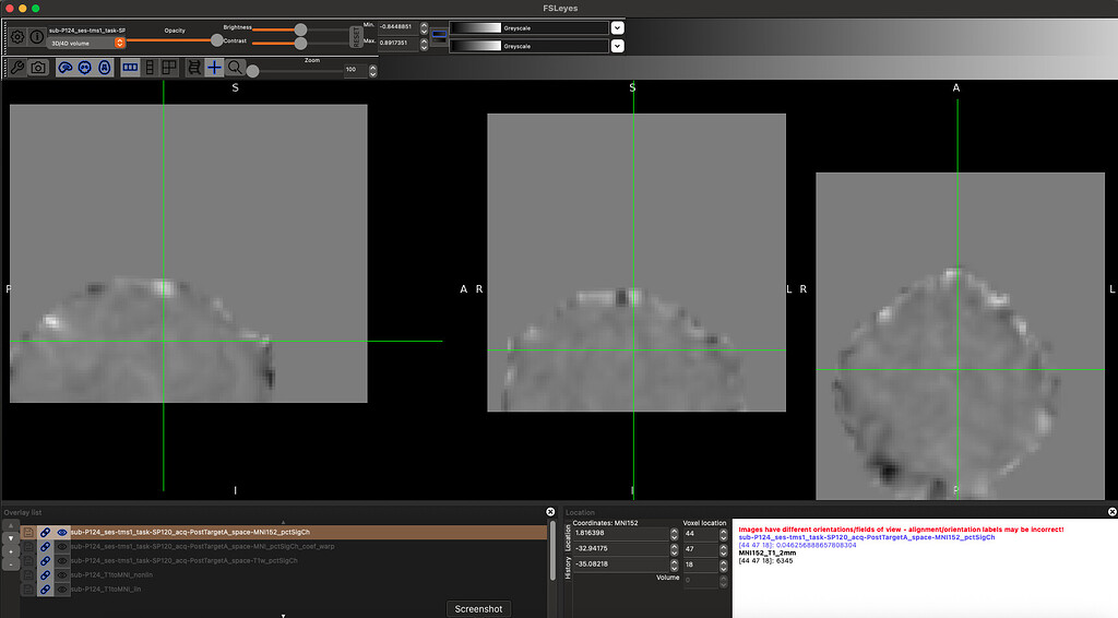 Transforming FEAT Stats Image from T1 to MNI - Software Support ...