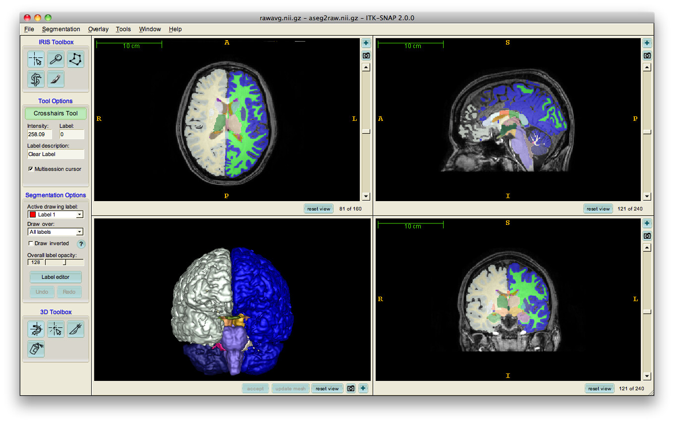 Transforming freesurfer segmentation labels into MNI space - fmriprep - Neurostars